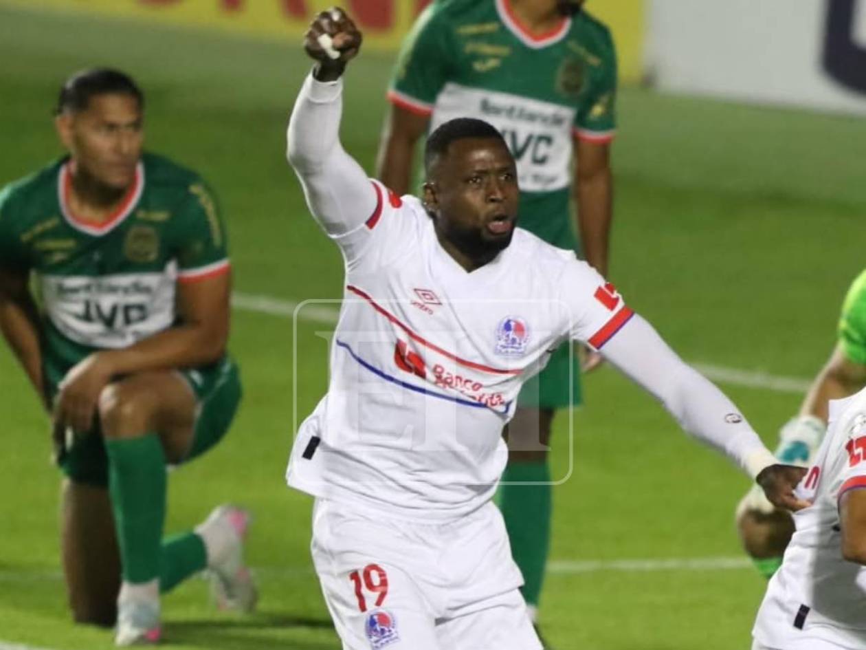 Arboleda habla del problema en su pierna, por qué se quedó en Olimpia y ...